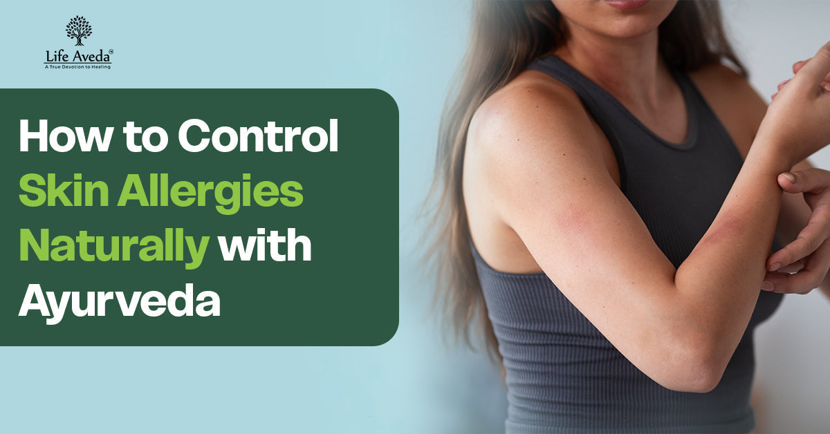 8 Effective Herbs for Allergic Rhinitis Relief – Life Aveda